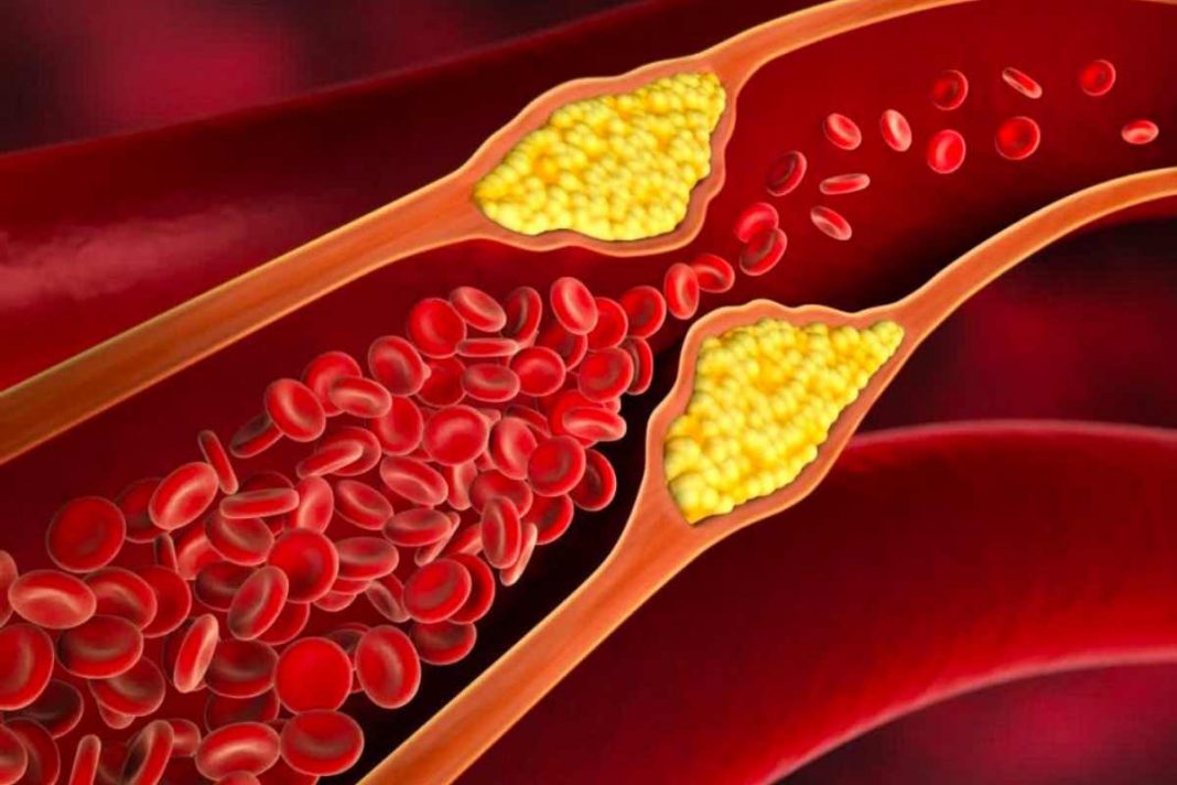 La verdad sobre el colesterol: así podemos moderarlo y mejorar nuestra ...
